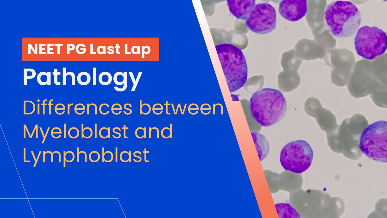 Pathology - Differences between Myeloblast and Lymphoblast