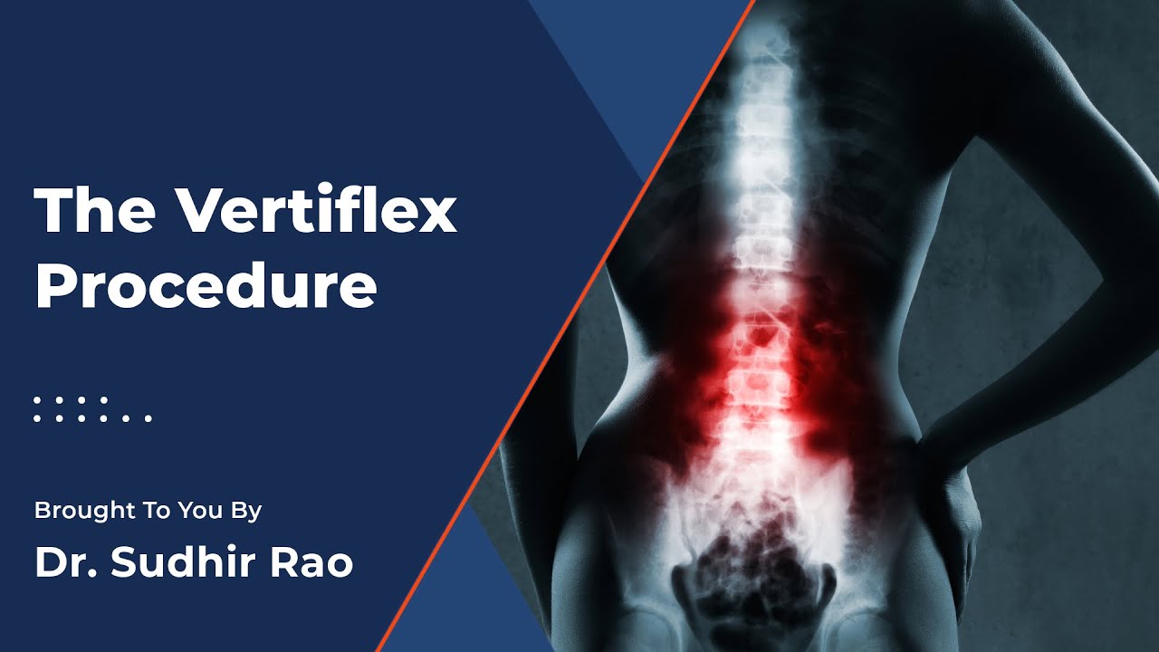 Vertiflex Treatment | Pain and Spine Specialists