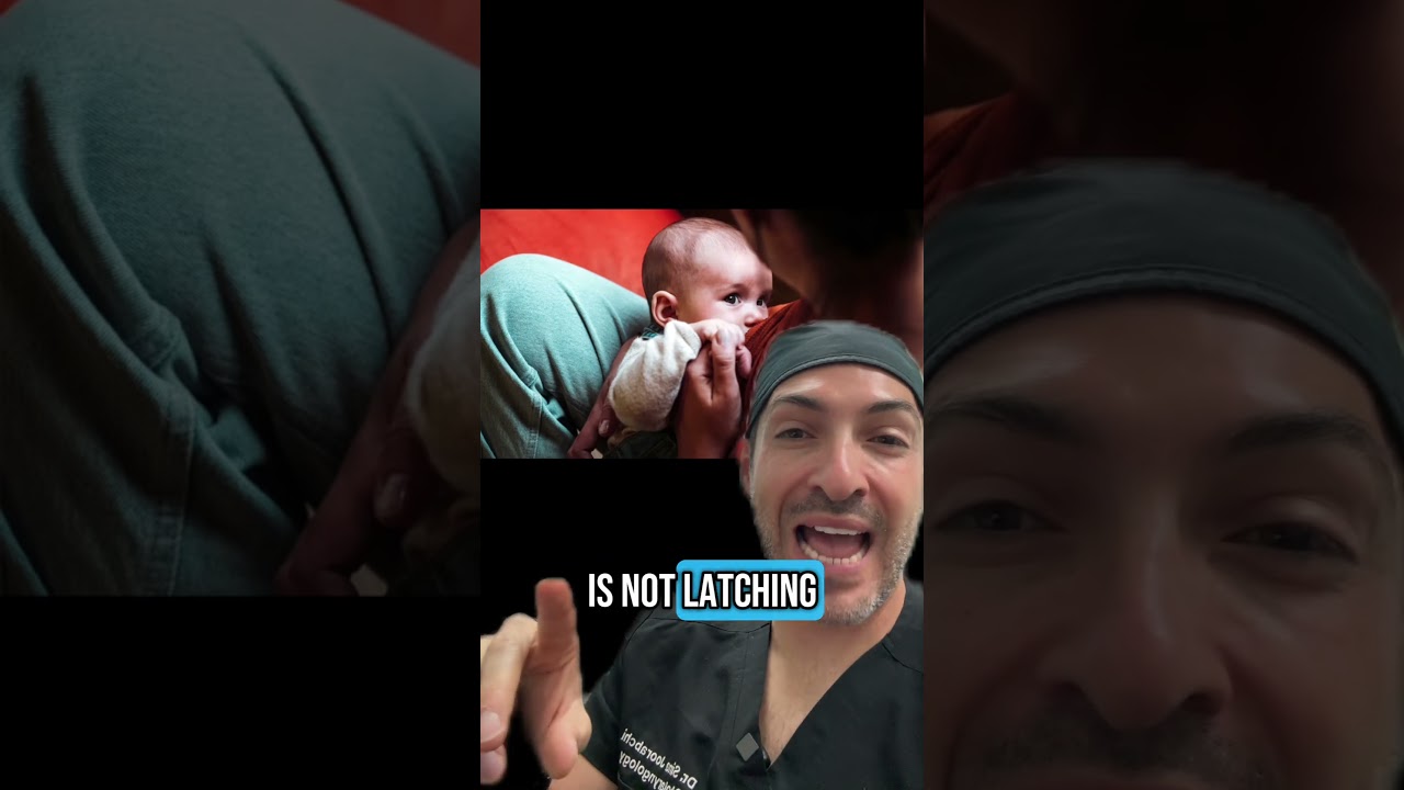 Does your baby have tongue tie? #infant t