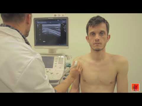 ultrasound of the shoulder I