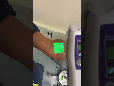 High Tech Vein Finder #trending #viral #shorts #nurselife #technology