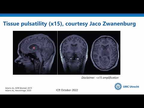 Non-invasive methods to image the brain clearance system
