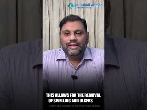 Surgery versus radiation for head and neck cancer's #drsuhailahmed #cancerawareness