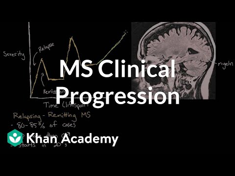 Defining the clinical course of multiple sclerosis – supok4okep