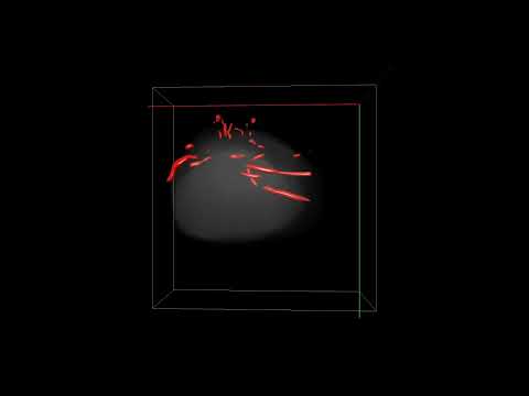 3D images of benign and malignant breast tissue masses