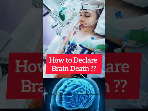 how to Declare Brain Death #braindeath #coma #medicine #neurology
