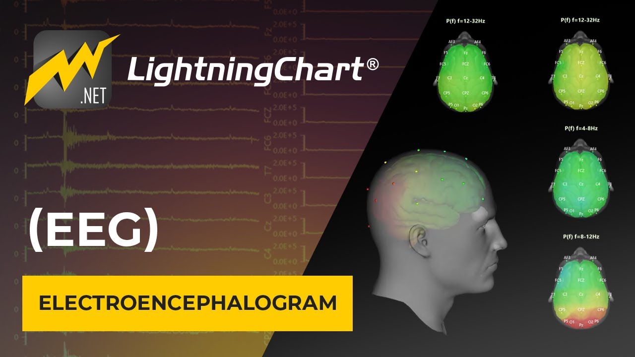 Visualizing an Electroencephalogram (EEG) chart with .NET charts