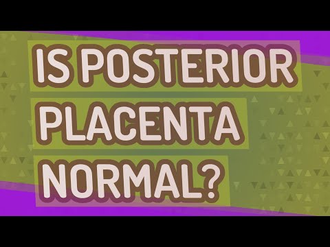 Is posterior placenta normal?