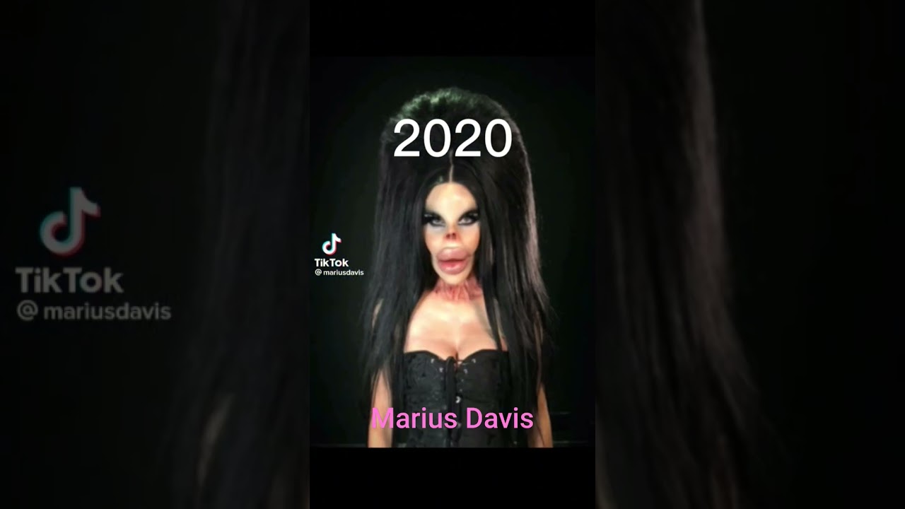 Marius Davis histoire