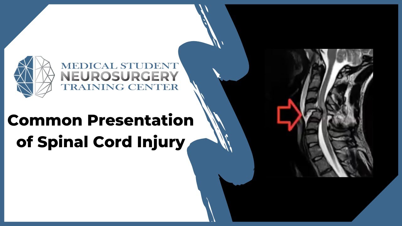 Common Presentation of Spinal Cord Injury