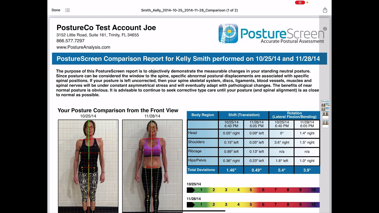 Comparison Module for PostureScreen, LeanScreen, & SquatScreen
