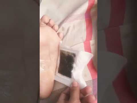 Foot Detox pads | shocked for what I saw #shorts #footdetox #kinoki #footpads#detox
