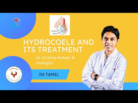 All about hydrocoele and its treatment in Tamil by Dr. Krishna Mohan