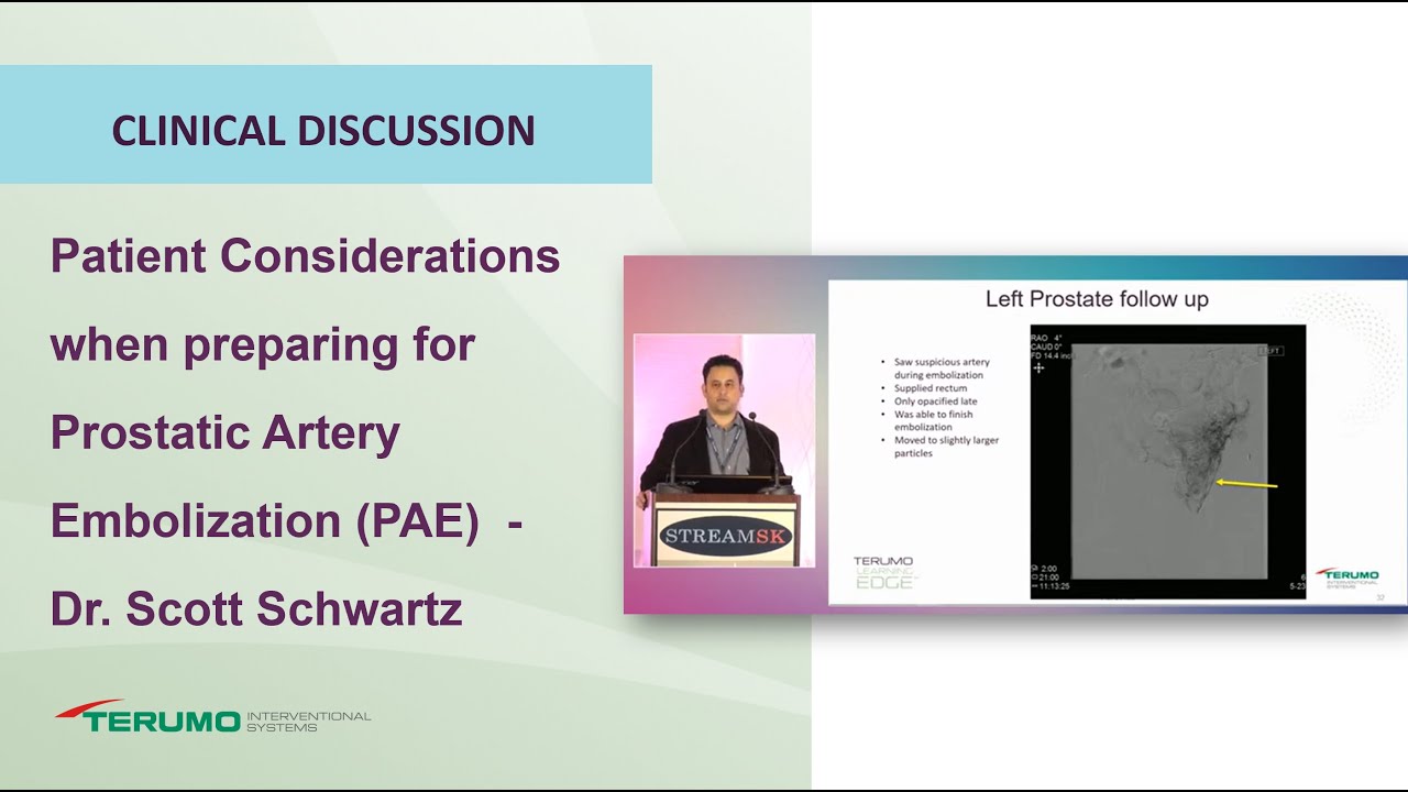 Patient Considerations when preparing for Prostatic Artery Embolization (PAE) |Terumo Interventional