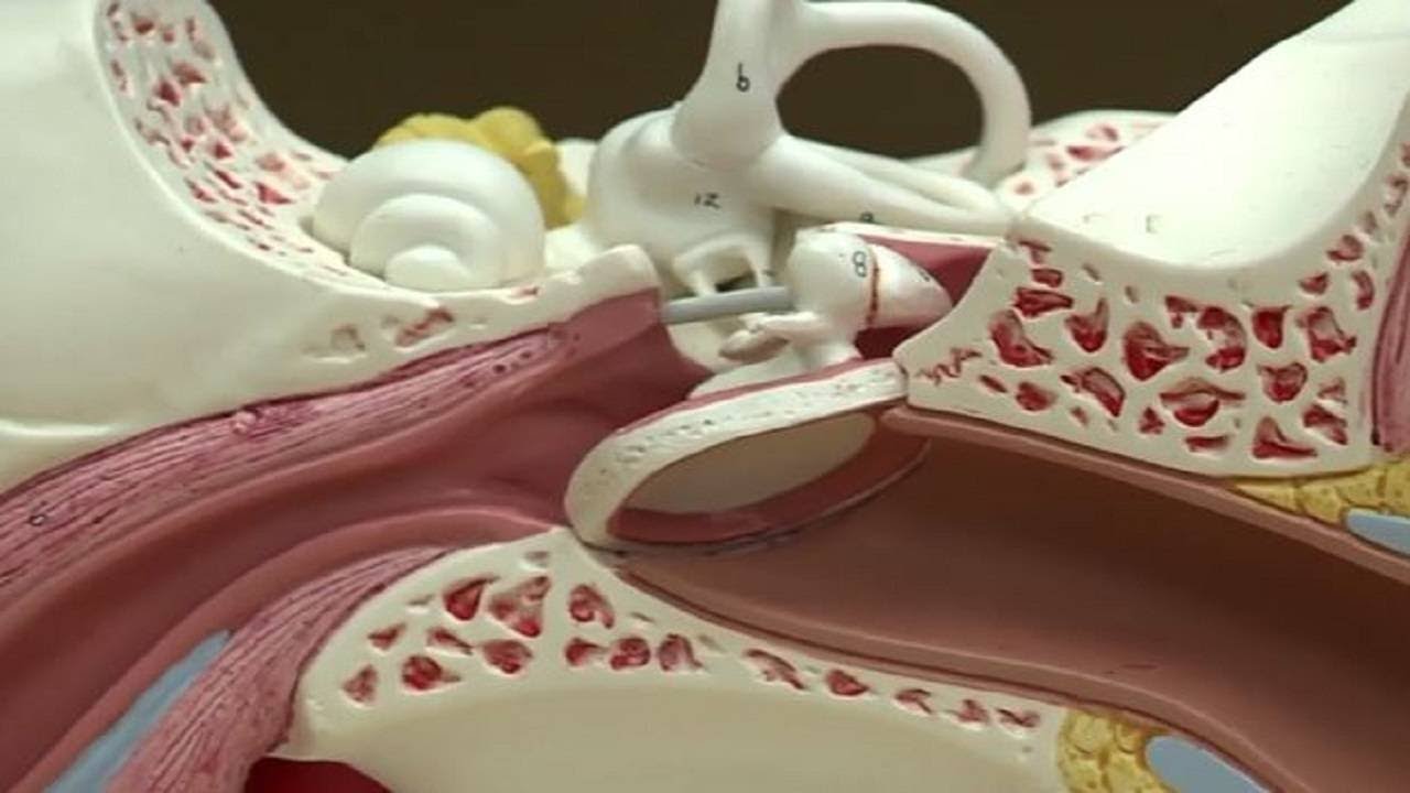 Are you suffering from hidden hearing loss?