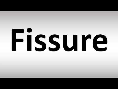 How to Pronounce Fissure