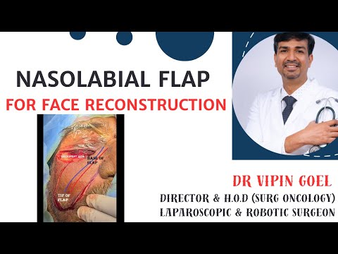 Nasolabial Flap for Face Reconstructionby • Video • MEDtube.net