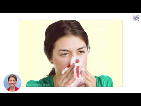 Patient Pulse: Managing Nosebleeds When You're on Anticoagulation