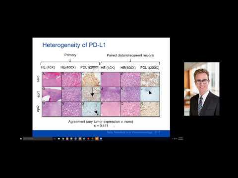 Aaron Mansfield: Neo-antigenic Potential of Chromosomal Rearrangements in Mesothelioma