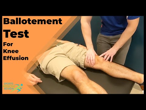 Ballottement Test (for Knee Effusion)