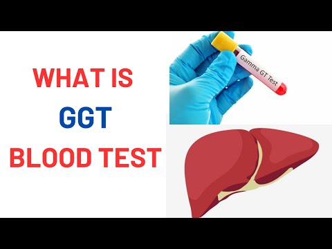 What is GGT Blood Test? Normal Levels, Liver Health