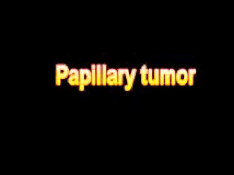 What Is The Definition Of Papillary tumor Medical School Terminology Dictionary