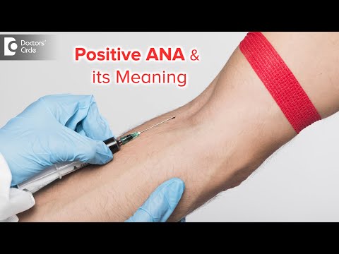 ANA+ (Antinuclear Antibodies)| Common Disease, Test & Treatment-Dr. Surekha Tiwari | Doctors' Circle