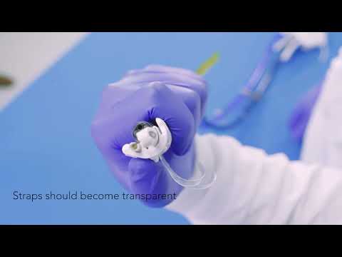 Apollo EndoSurgery