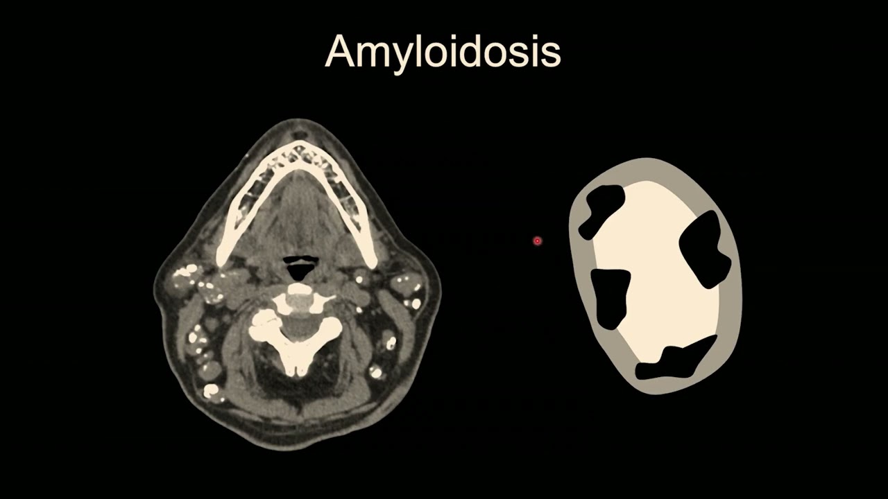 016 Cervical Lymphadenopathy – New Concepts and Classifications Medstudylab.com