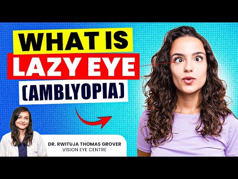 What is LAZY EYE (Amblyopia) and Its Causes | How To FIX Lazy Eyes | Vision Eye Centre