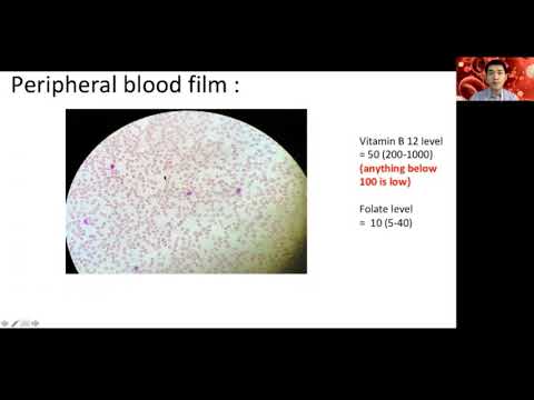 Haematology Week 1 - Approach to Pancytopenia