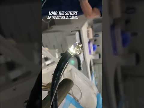 Suturing Device For The Suture Sculpt *Endoscopic Sleeve* Procedure! #weightloss