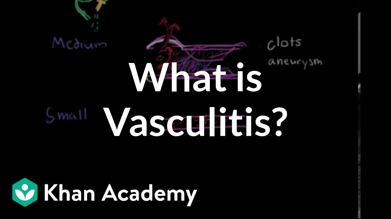 What is vasculitis? | Circulatory System and Disease | NCLEX-RN | Khan Academy