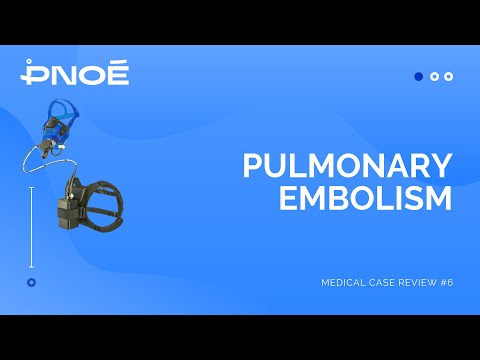 Medical Case Series | Ep. 1 - Pulmonary Embolism