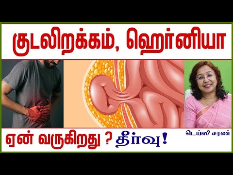 Reasons of Hernia | easy solutions | DAISY HOSPITAL | Chennai