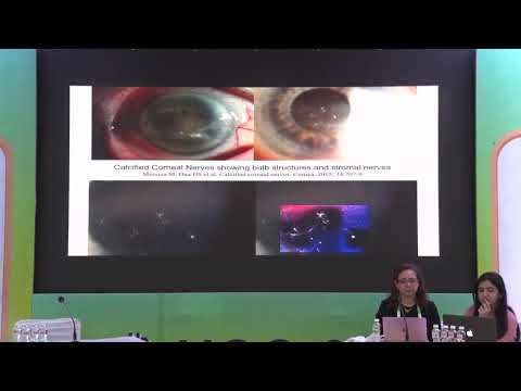 AIOC2020 GP134 T1 Dr Harminder S Dua Nomenclature, Definition and Diagnosis; Classification and Ca
