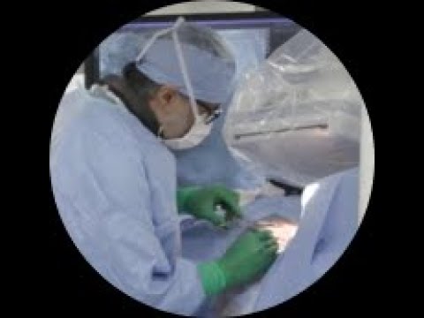 Same Day Discharge and Next Day Check with the CareLink Express™ Mobile System