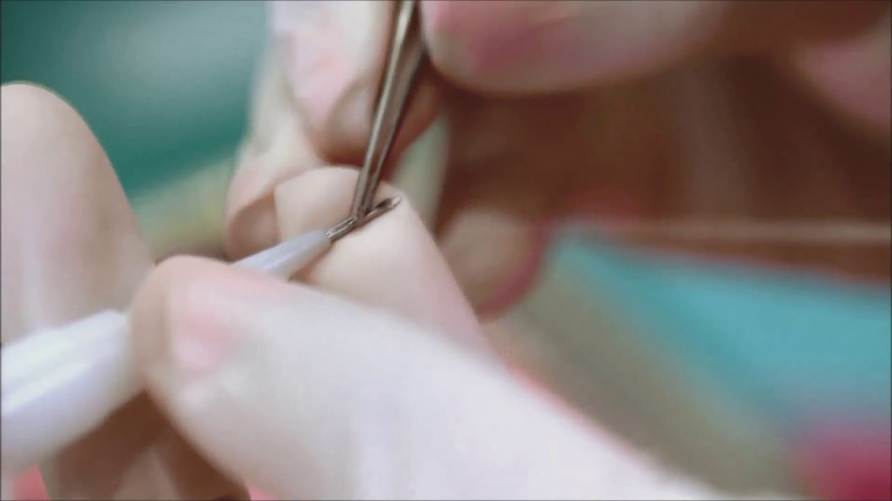 Hair Restoration and Hair Loss Treatment - DHI Global