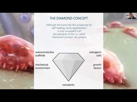 Webinar 30-01-2021 | C-Tech and the new Biomaterials for Guided Tissue Regeneration