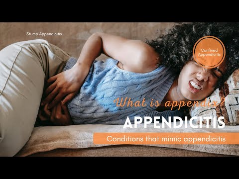 Appendicitis and conditions that mimic it!