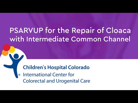 Repair of Cloaca with Intermediate Common Channel (PSARVUP)