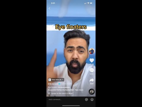 Doctor reacts to eye Floaters #shorts