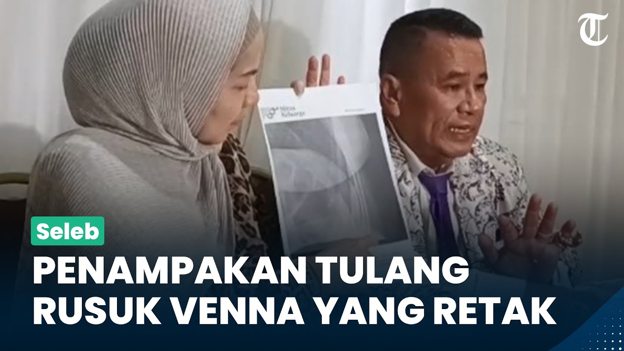Penampakan Tulang Rusuk Venna Melinda yang Retak dan Pembuluh Darah Hidung yang Pecah - Tribun Video
