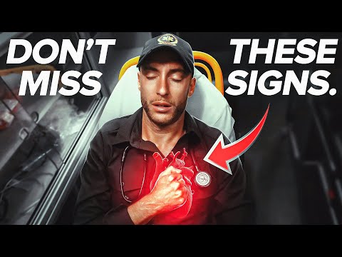 HEART ATTACK Signs You Might Miss...