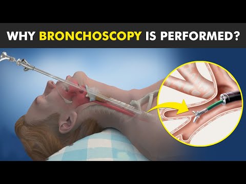 Bronchoscopy - Procedure To View Inside Of Air Ways
