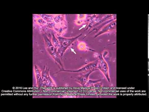 Cellular uptake and fate of fibroin microspheres in 3T3 cells - Video S2 [103830]