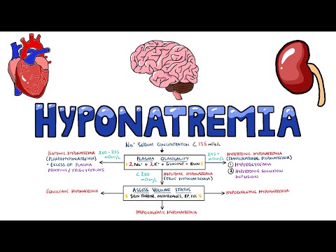 An Approach to Hyponatremia - Hyponatremia Diagnostic Algorithm | Hyponatremia Causes MADE EASY