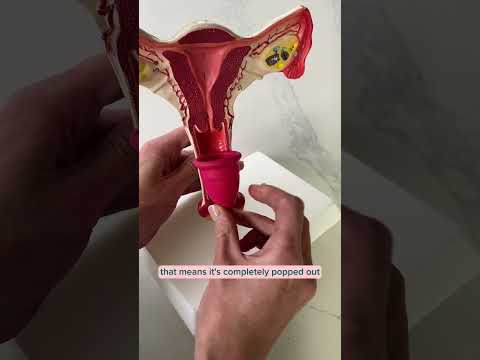 How to use a Menstrual Cup and what size am I? - Thank you @thepcosnutritionist7214 for the video!