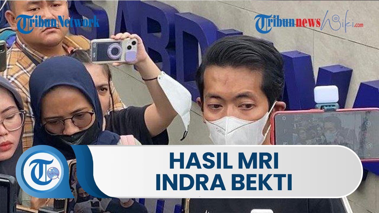 Hasil MRI Menunjukkan Perkembangan Sangat Baik, Adik Indra Bekti: Betul ...