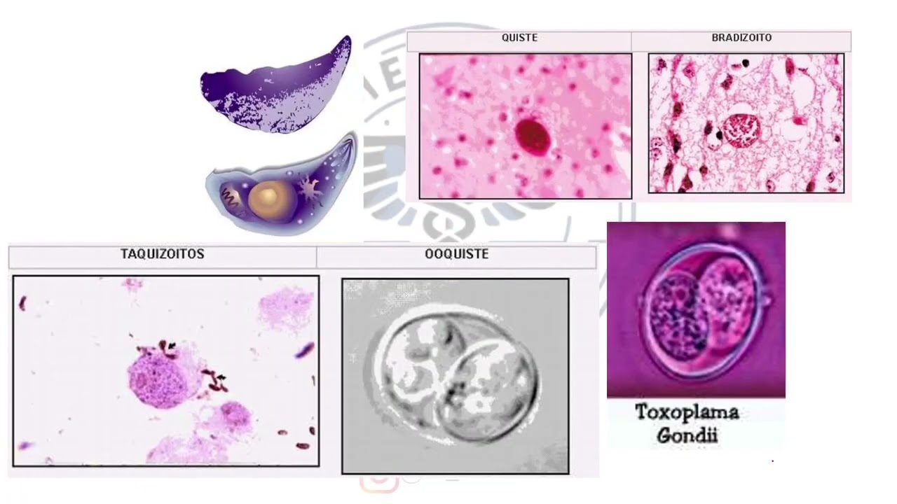 CICLO VERANO 2024 - PARASITOLOGÍA MEDICA - SEMANA N°7